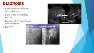 renal disorders..............pptx