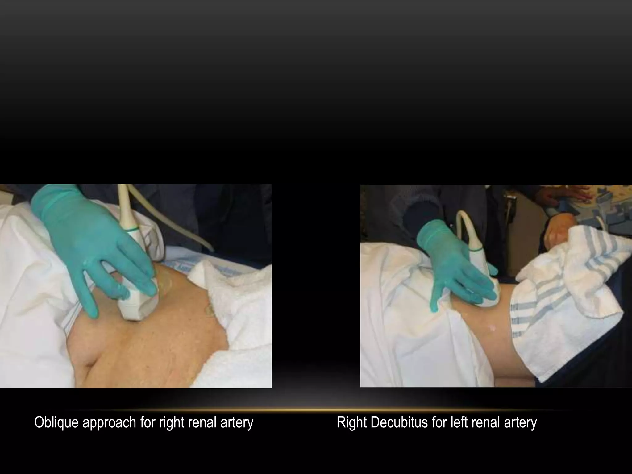 Renal doppler | PPTX