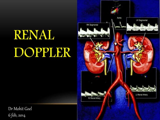 Renal doppler | PPTX | Heart and Cardiovascular Diseases | Diseases and ...