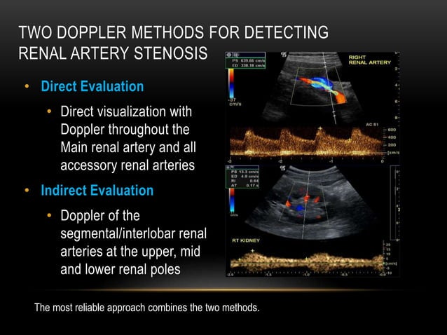 Renal doppler | PPTX | Heart and Cardiovascular Diseases | Diseases and ...