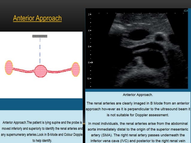 Renal doppler | PPTX | Heart and Cardiovascular Diseases | Diseases and ...