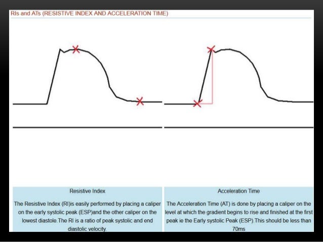 Renal doppler