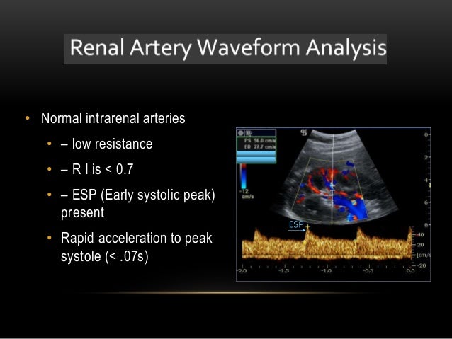 Renal doppler