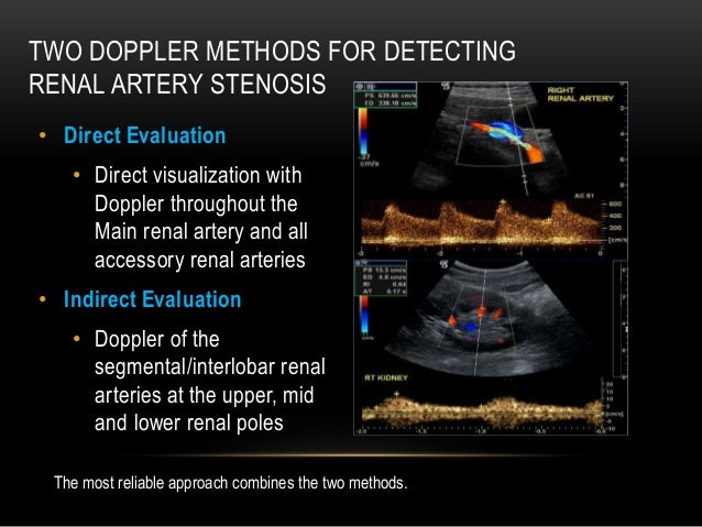Renal doppler