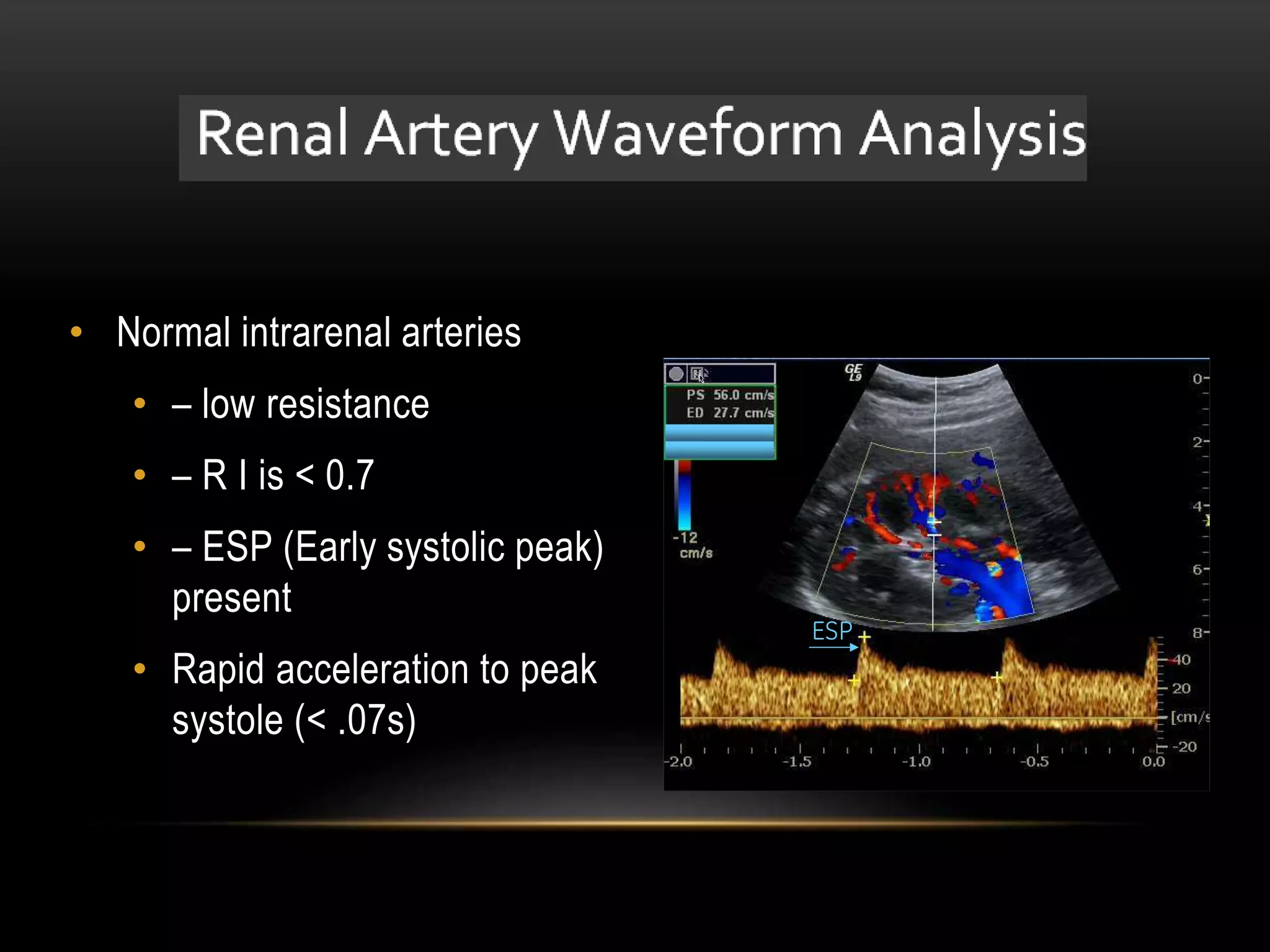 Renal doppler usg | PPTX