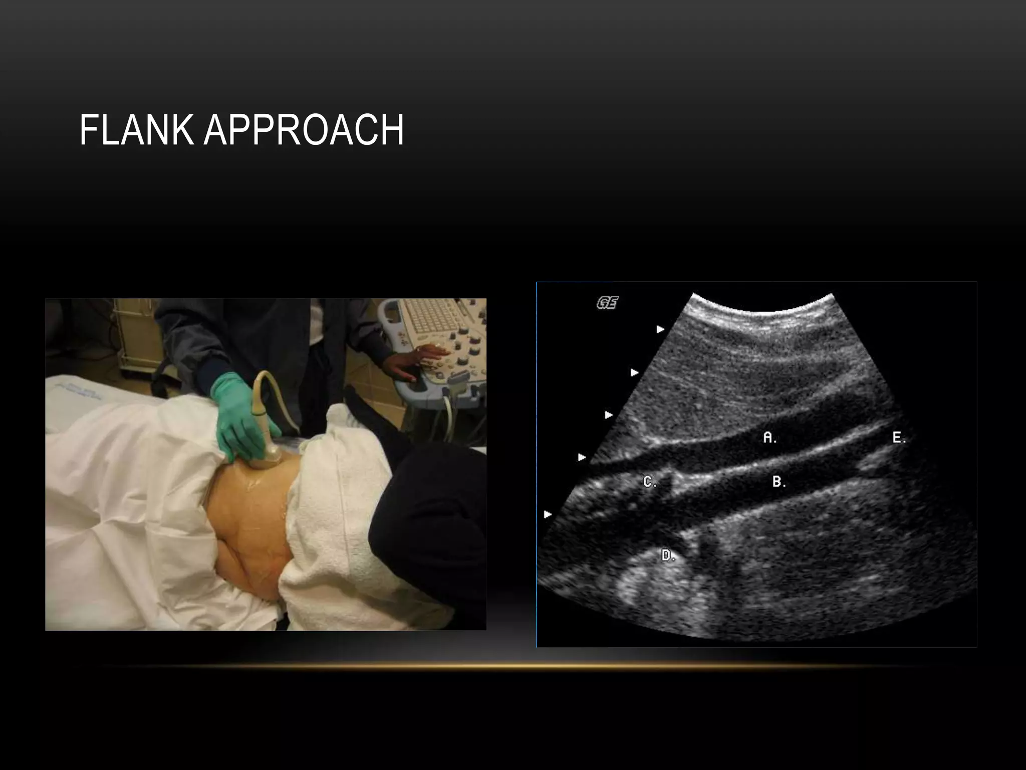 Renal doppler usg | PPTX