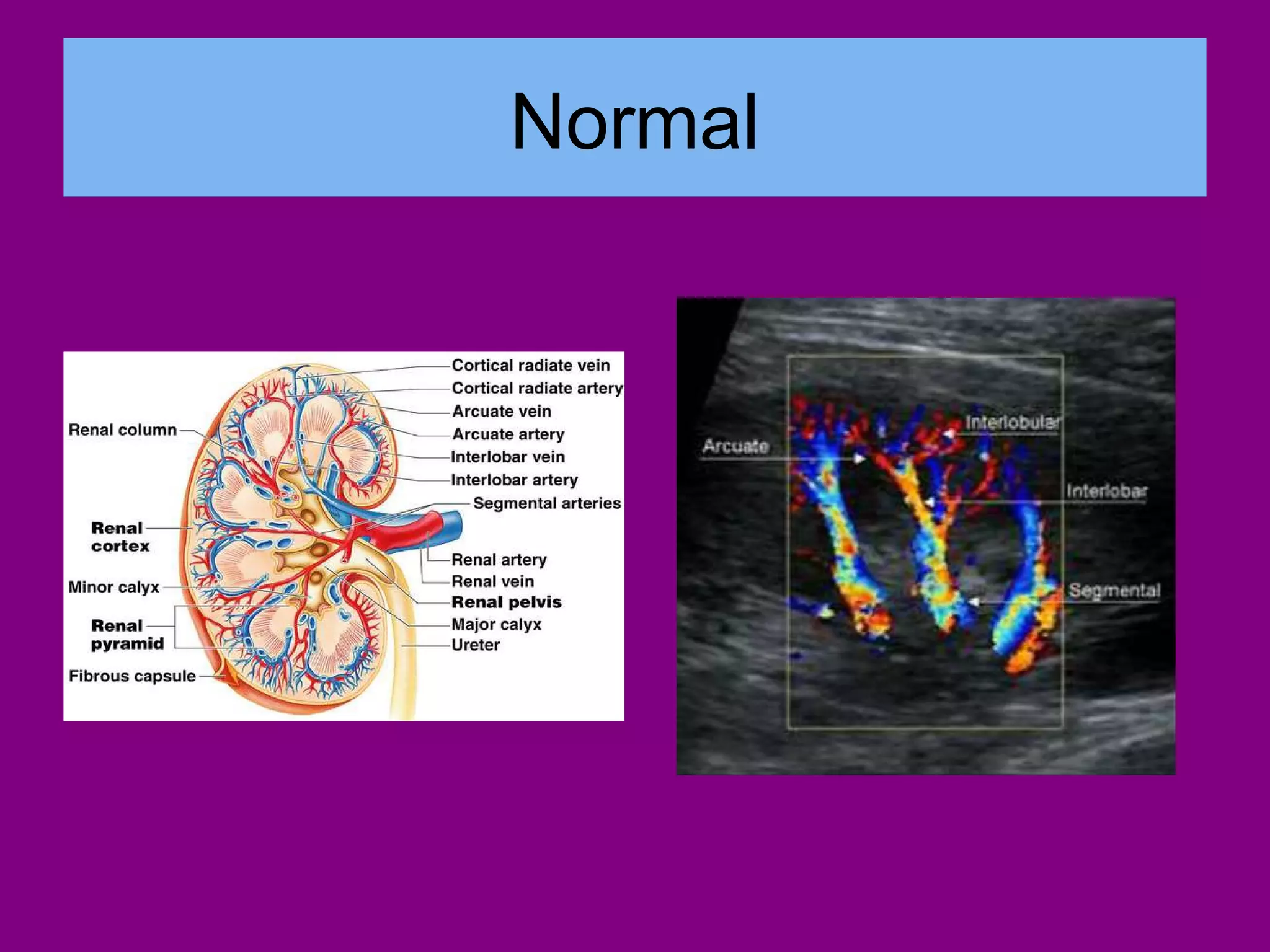 Renal doppler ultrasound | PPT