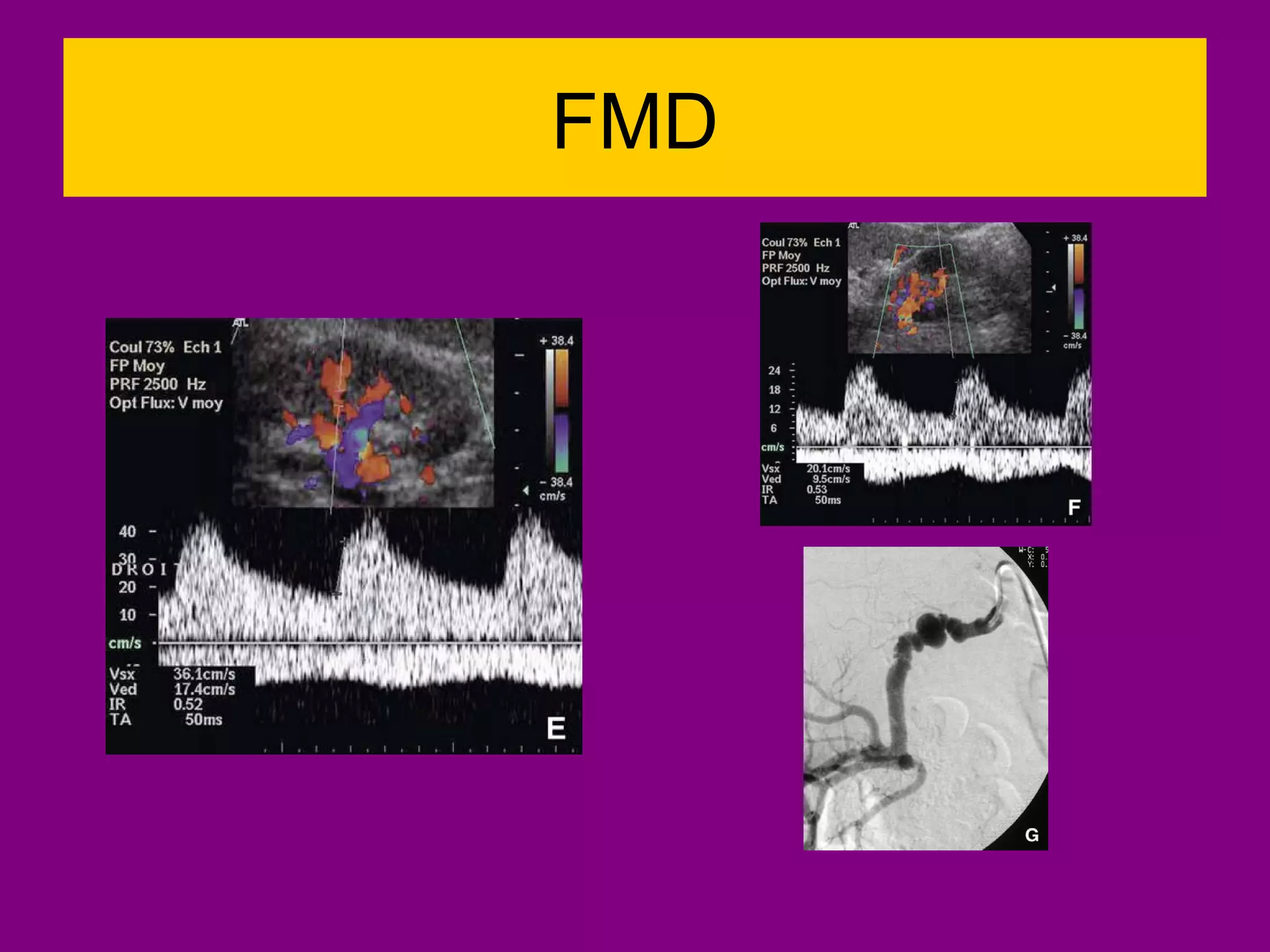 Renal doppler ultrasound | PPT