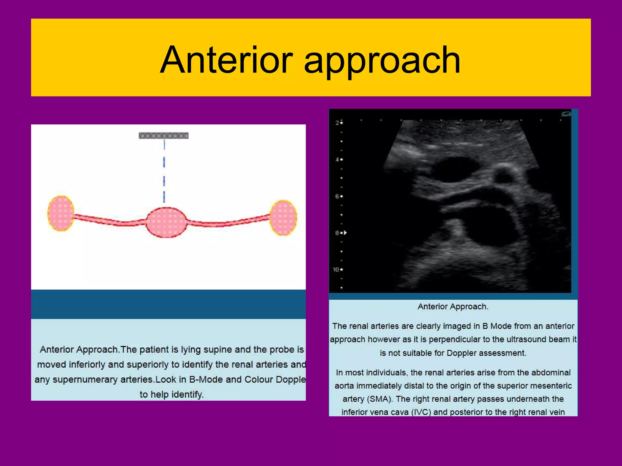 Renal doppler ultrasound | PPT