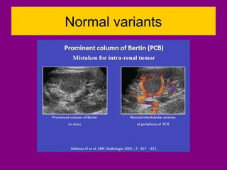 Renal doppler ultrasound | PPT
