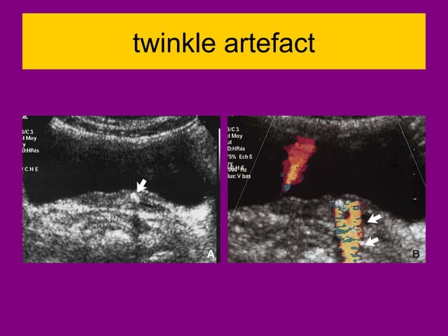 Renal doppler ultrasound | PPT