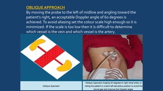 Basics of Renal Doppler | PPTX