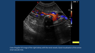 Basics of Renal Doppler | PPTX
