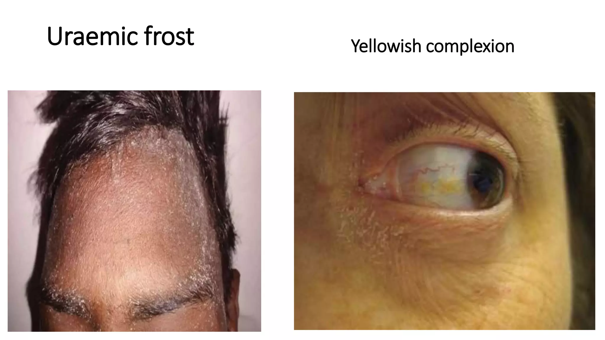 RENAL EXAMINATION.pptx