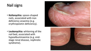 RENAL EXAMINATION.pptx
