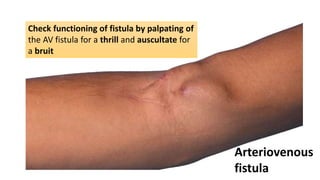 RENAL EXAMINATION.pptx