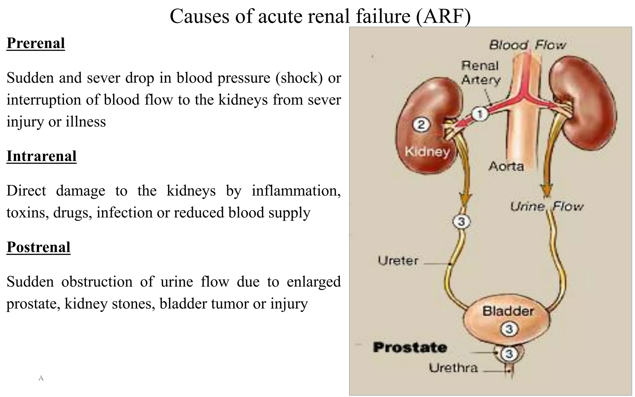 Renal failure | PDF