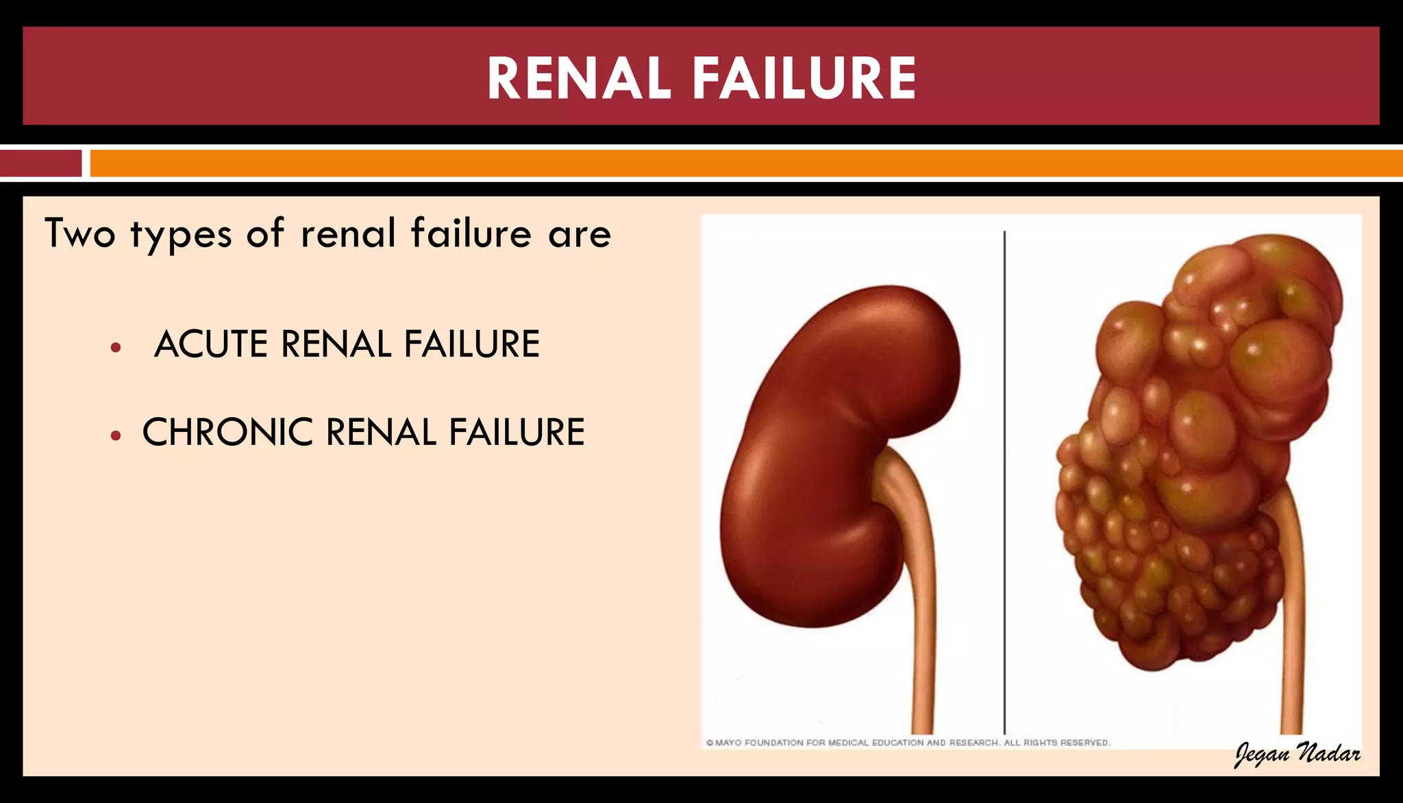 Pathophysiology of Renal failure | PDF