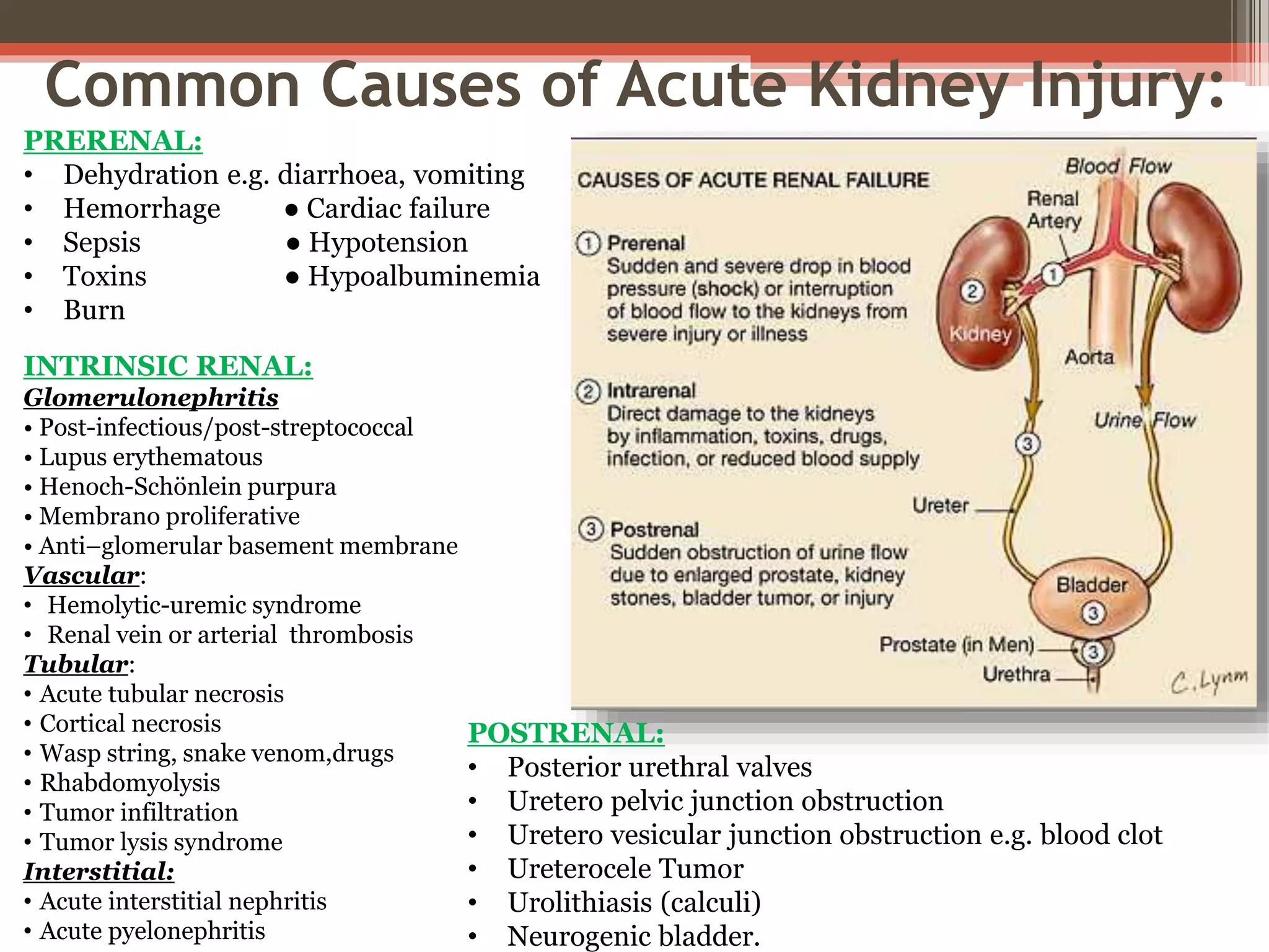 Renal failure in children | PPTX