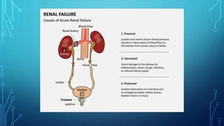 renal failure.pptx