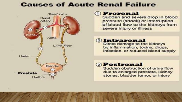 Renal failure.pptx