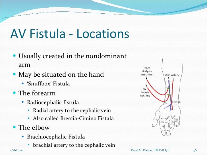 Renal failure and dialysis