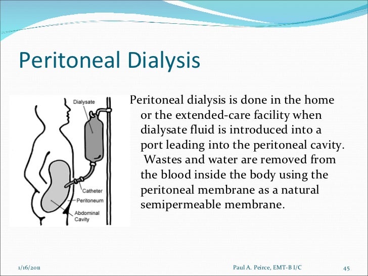 Peritoneal Dialysis Types And Process Of Peritoneal Dialysis