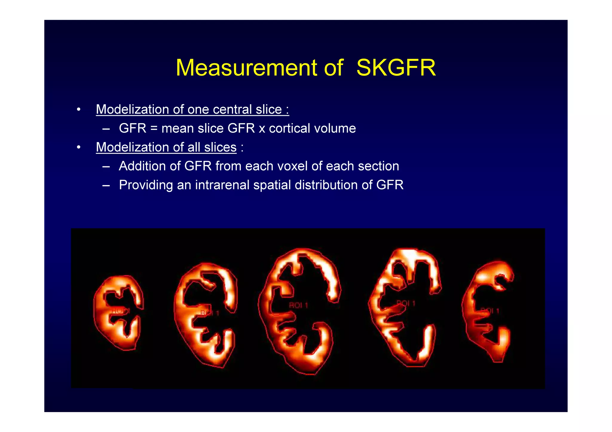 Renal_function_and_GFR_with_MR_imaging.pdf