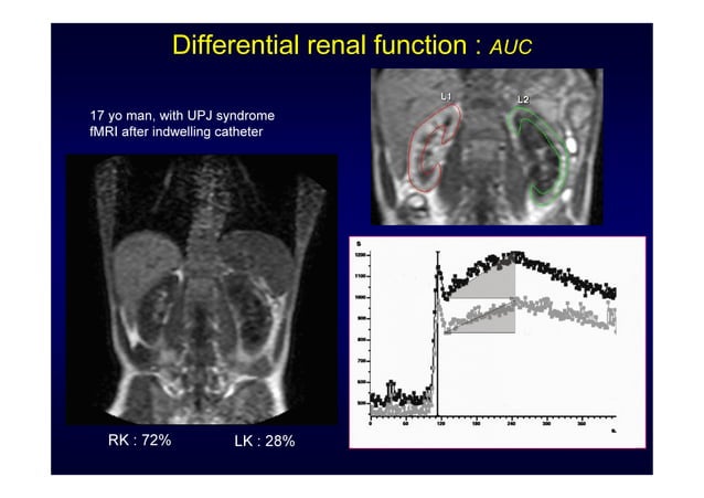 Renal_function_and_GFR_with_MR_imaging.pdf