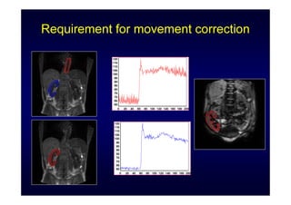 Renal_function_and_GFR_with_MR_imaging.pdf