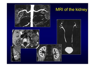 Renal_function_and_GFR_with_MR_imaging.pdf