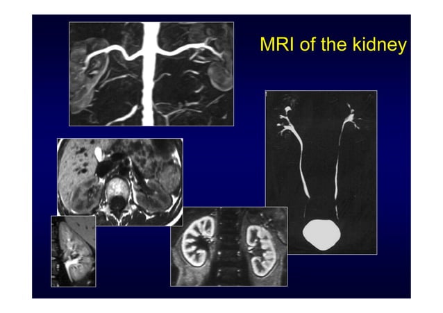 Renal_function_and_GFR_with_MR_imaging.pdf
