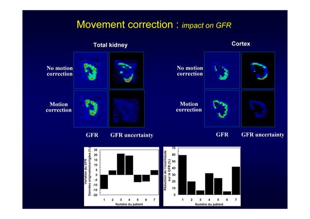 Renal_function_and_GFR_with_MR_imaging.pdf