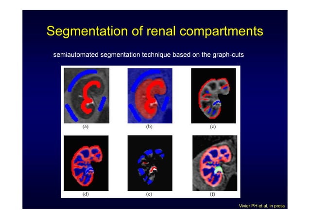 Renal_function_and_GFR_with_MR_imaging.pdf