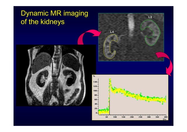 Renal_function_and_GFR_with_MR_imaging.pdf