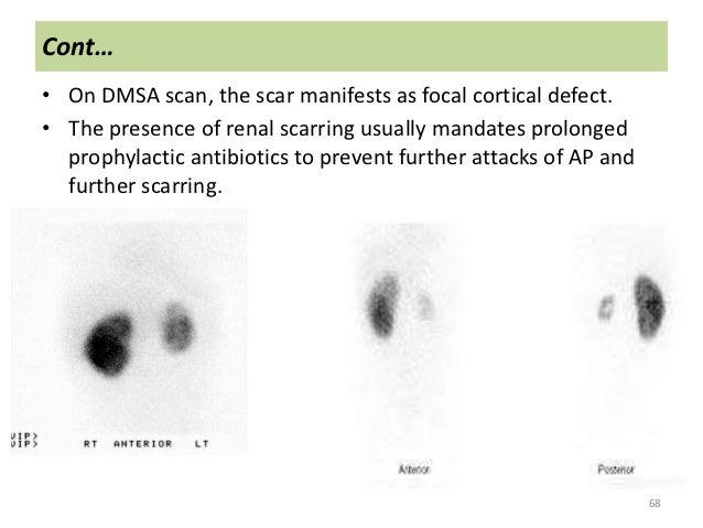 Renal Function Tests by Dr.Ankur Puri