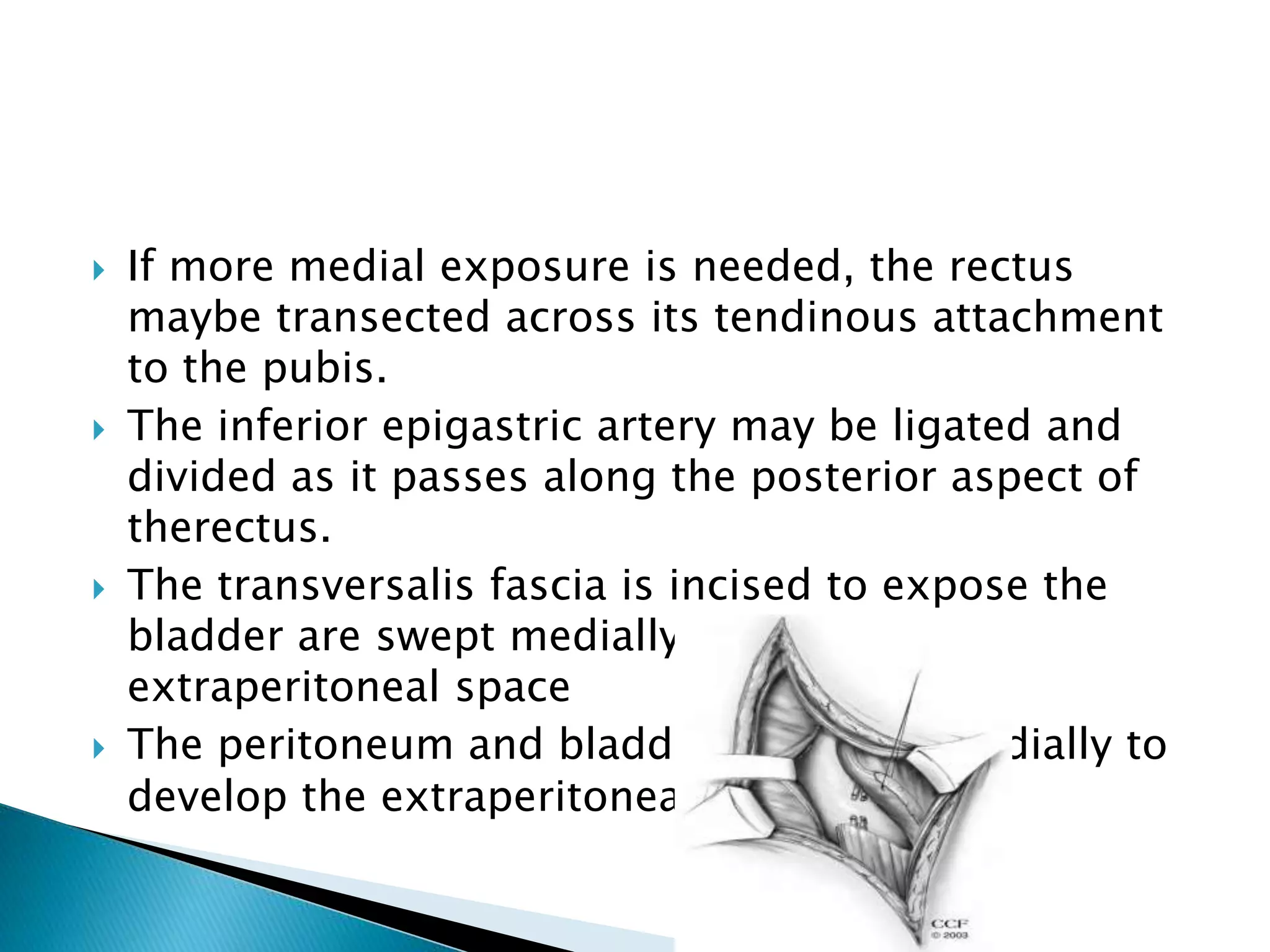 Renal incision | PPTX