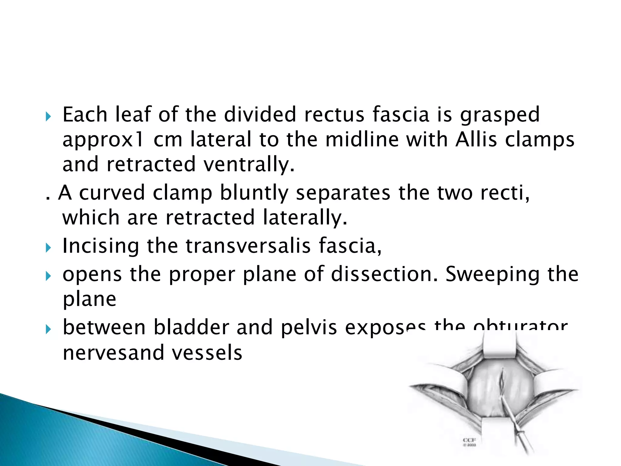 Renal incision | PPTX