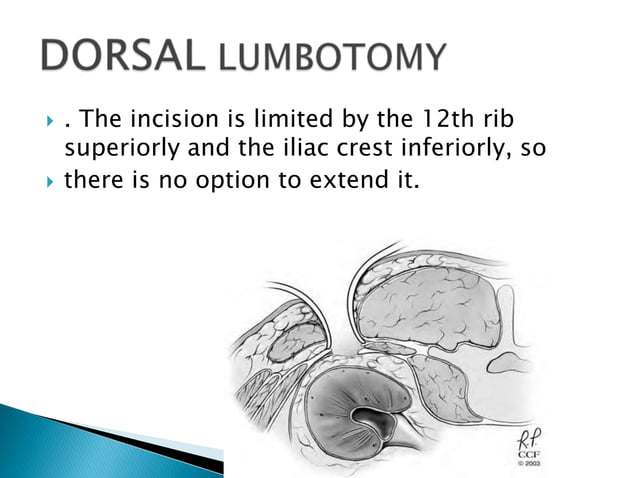 Renal incision | PPTX | Death, Injury, or Military Conflict | Sensitive ...