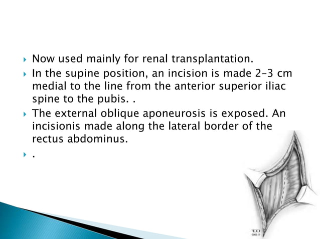Renal incision | PPTX | Death, Injury, or Military Conflict | Sensitive ...