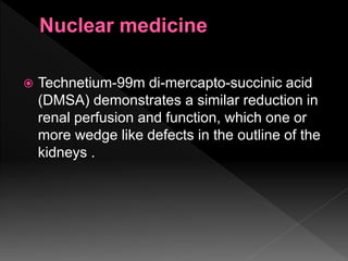 Renal infections radiology | PPTX