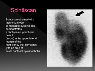 Renal infections radiology | PPTX