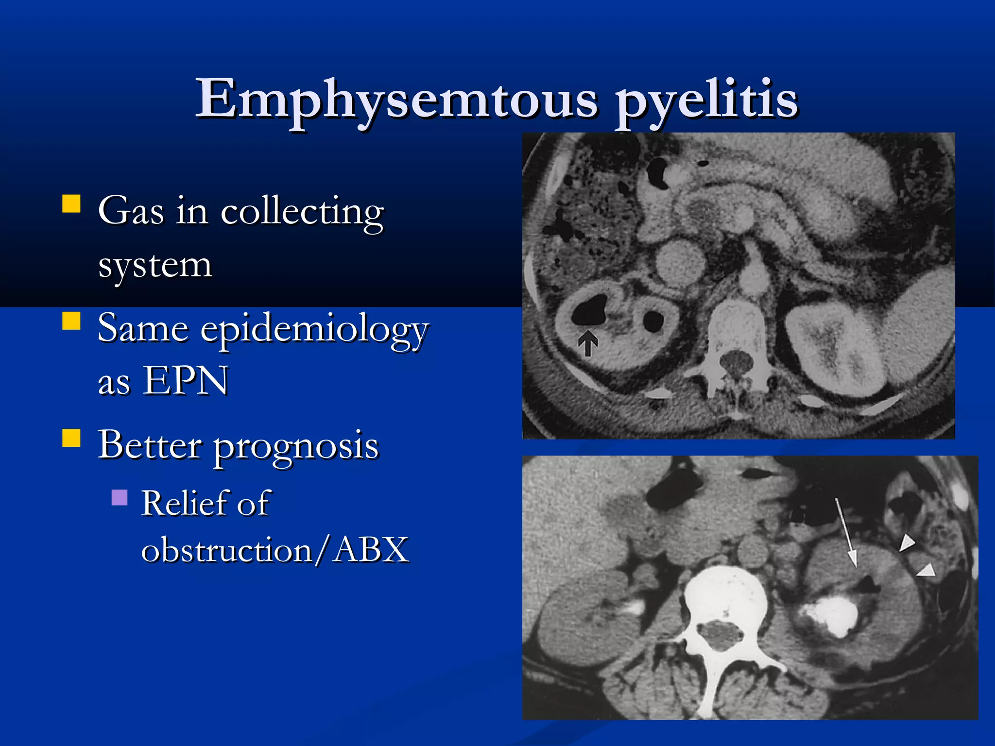 Renal inflammatory disease | PPT