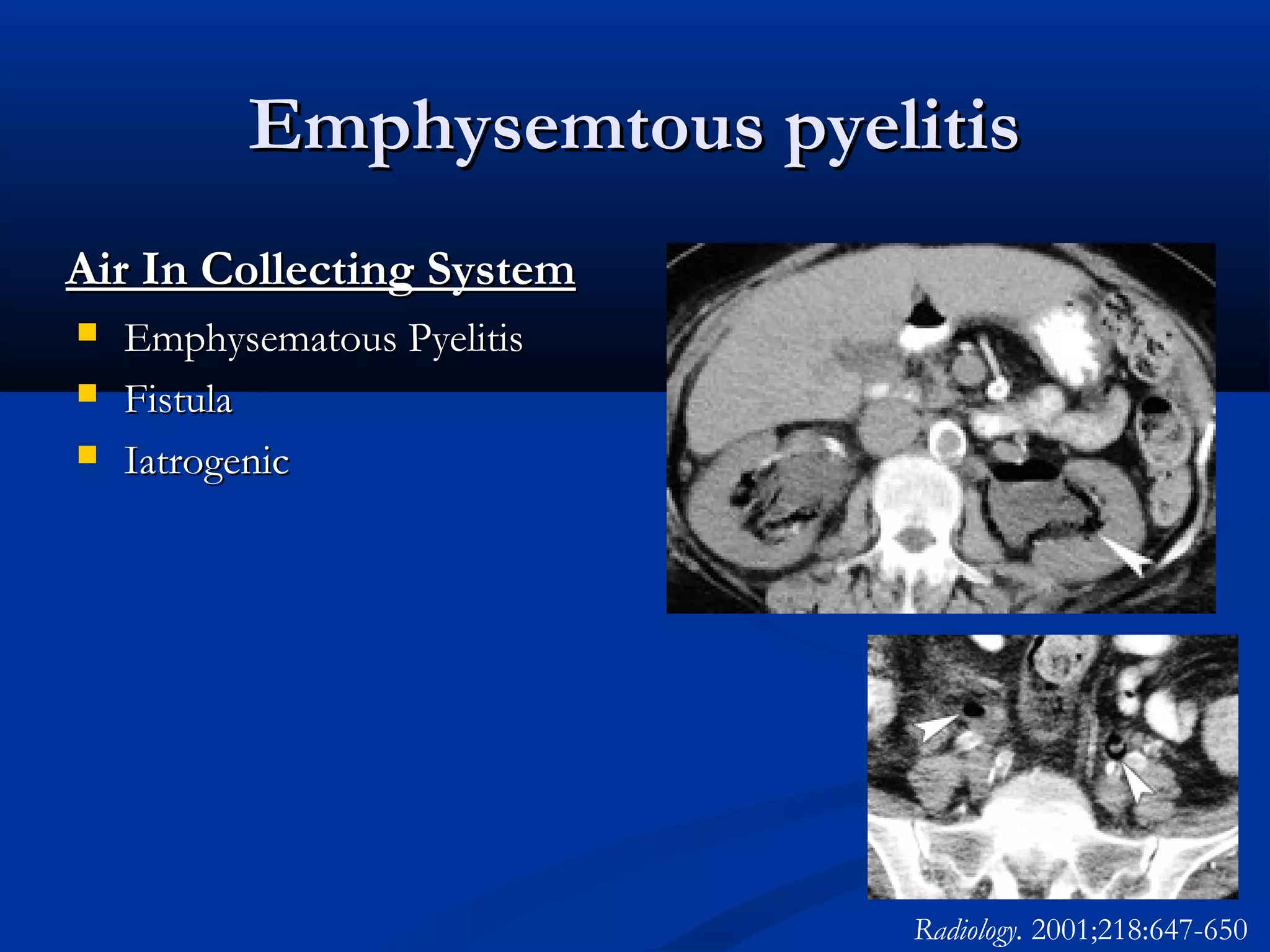 Renal inflammatory disease | PPT