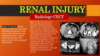 RENAL INJURY-ABDOMINAL TRAUMA.pptx