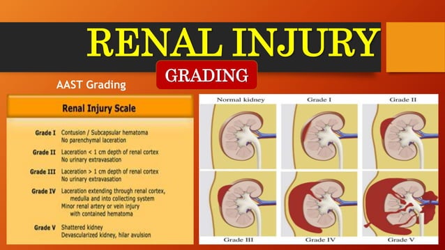 RENAL INJURY-ABDOMINAL TRAUMA.pptx | Death, Injury, or Military ...