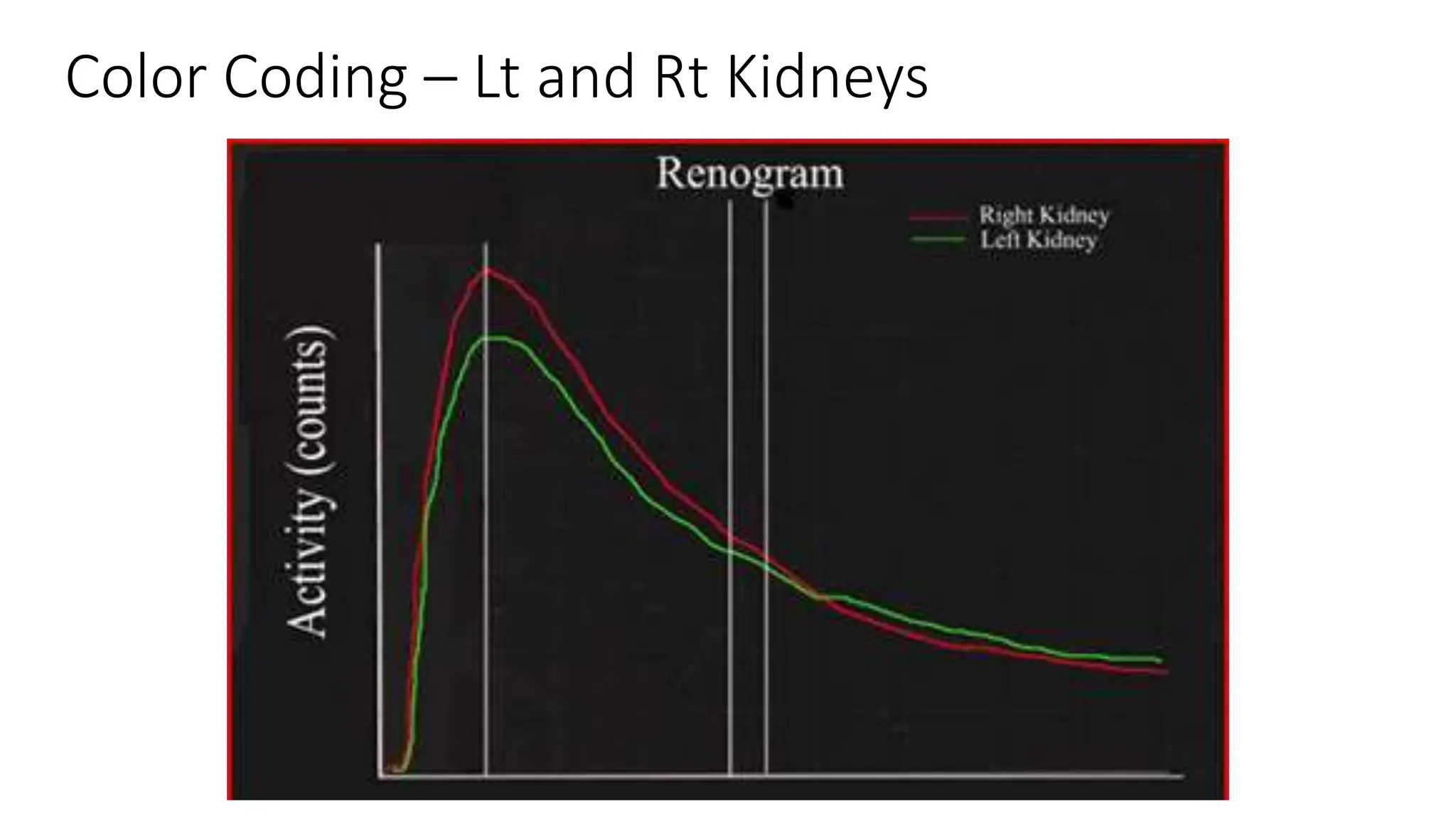 Renal Dynamic Scan - Isotope Scan - DTPA | PPTX