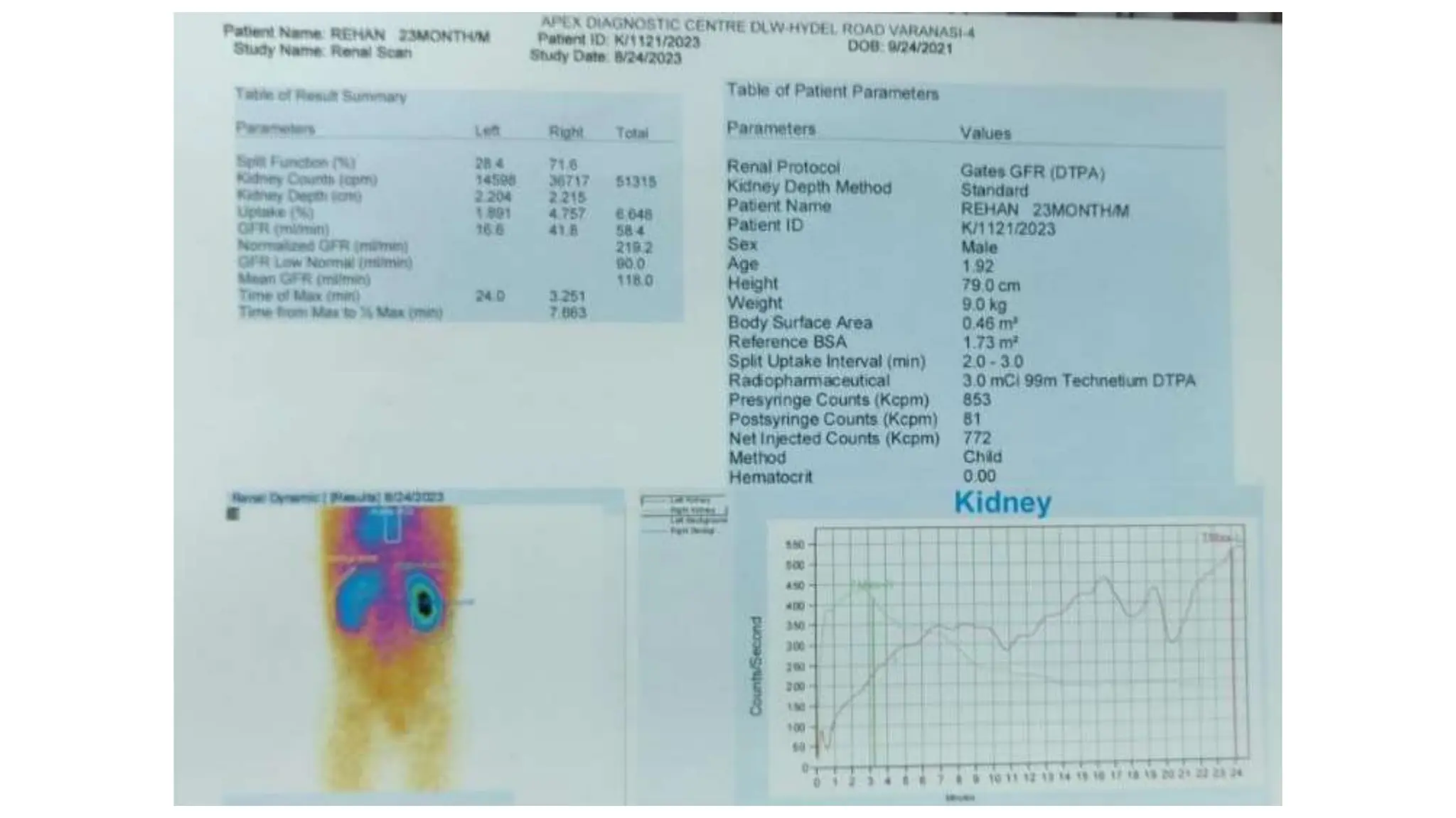Renal Dynamic Scan - Isotope Scan - DTPA | PPTX