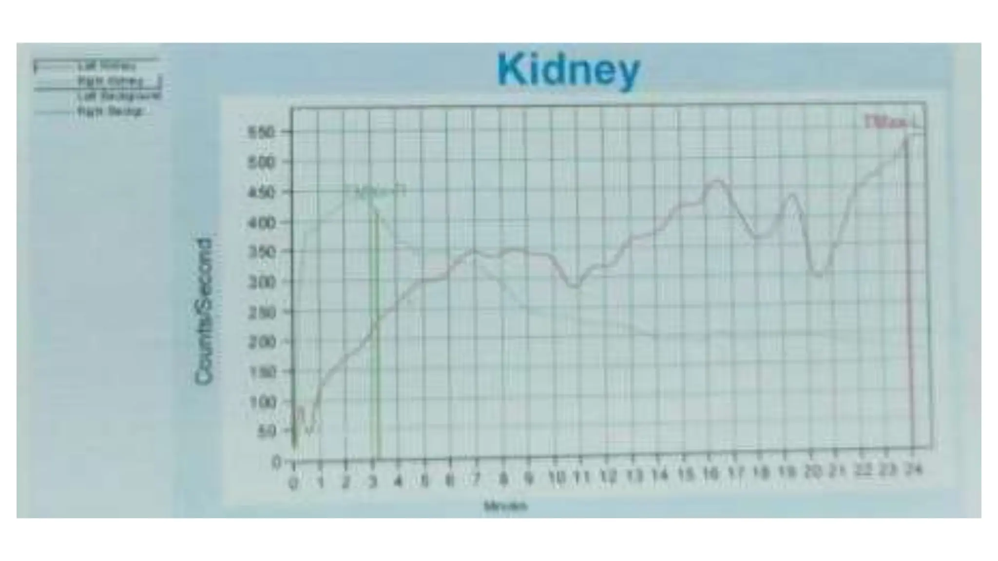 Renal Dynamic Scan - Isotope Scan - DTPA | PPTX