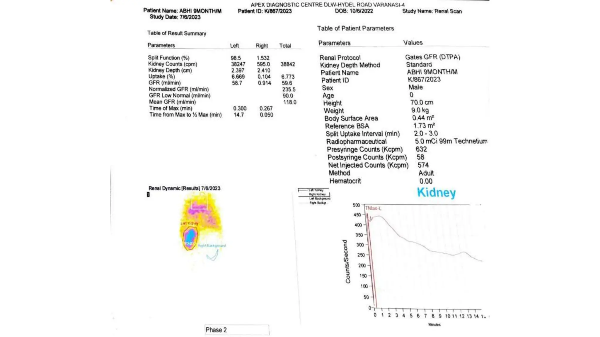 Renal Dynamic Scan - Isotope Scan - DTPA | PPTX